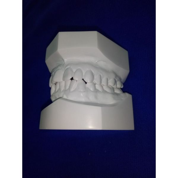Quality Dental Study Model with CAD CAM Digital Design and 3D Printing Workflow for for sale