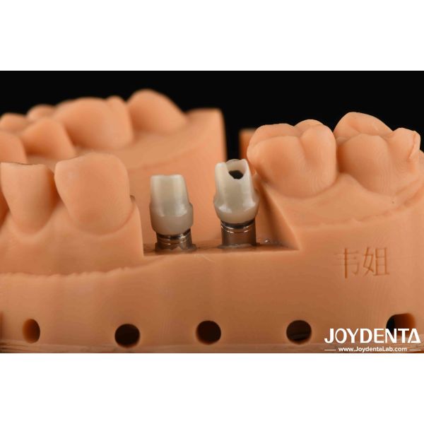 Quality Silver Color Dental Zirconia Abutments For Implants Customizable Diameter for sale