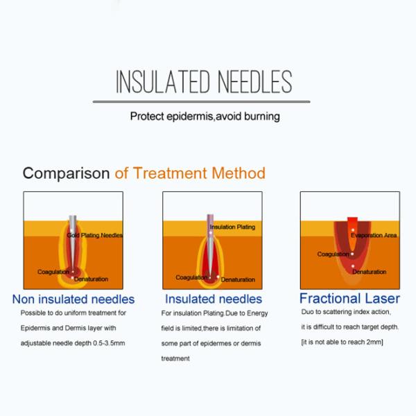 Quality Fractional Rf Microneedle Machine Strech Mark Vascular Veins Acens Pore Removal for sale