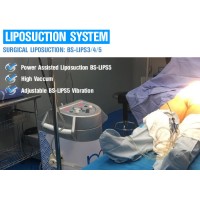 Quality High Pressure Vacuum Suction Surgical Liposuction Machine For Body Contouring​ for sale