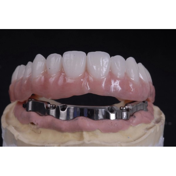Quality Long-lasting Full Metal-Ceramic Restoration with Natural Tooth Appearance Fully Customizable for Crowns and Bridges for sale