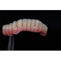 Quality High Success Rate All On Four All On Six Zirconia Titanium Dental Implants for sale