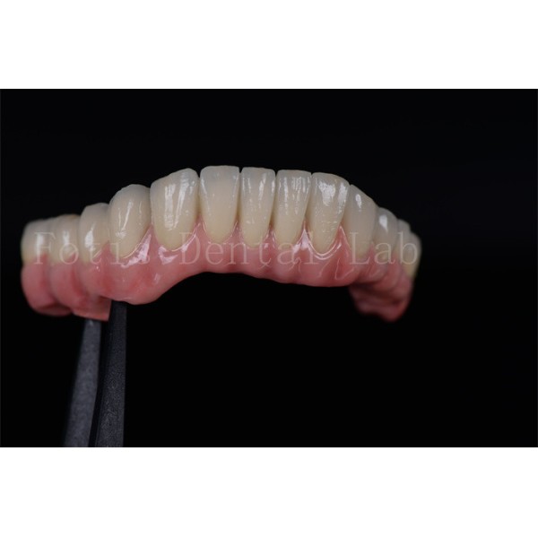 Quality High Success Rate All On Four All On Six  Zirconia Titanium Dental Implants Customized for sale