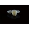 china High quality Dental Resin-bonded Maryland bridge from ADS China Dental Lab