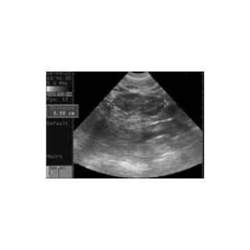 Quality B / W Palm Ultrasound Scanner Animal Ultrasound Scanner Using for Checking Mare for sale