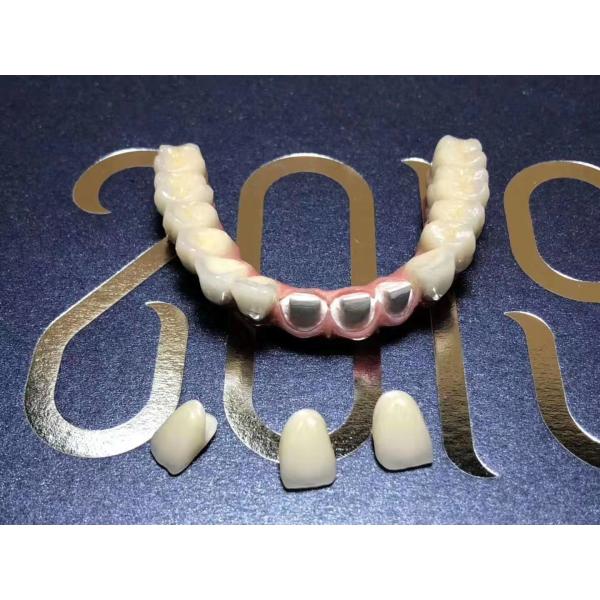 Quality Flexible Individual Titanium Removable Dental Crown For Dental Clinic for sale