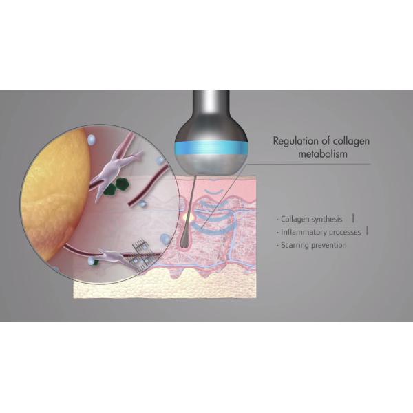 Quality LDM Ultrasound Skin Rejuvenation Machine Low Frequency Dual Frequency for sale