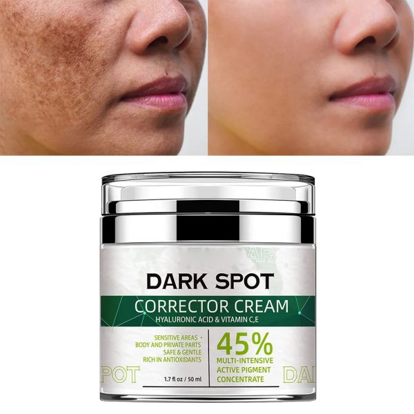 Quality Face Black Freckle Acne Fade Dark Spot Removing Corrector Whitening Cream for sale