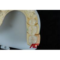 Quality Biocompatible Ceramic 3D Emax Veneers For Tooth Restorations for sale
