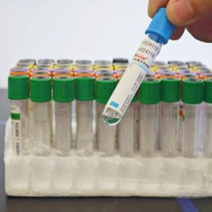 Quality PT Tube & Foundation For International Normalized Ratio Optimal For Automated for sale