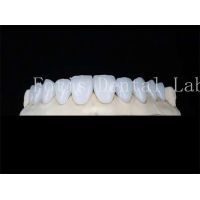 Quality Customized Natural Porcelain Veneers Dental Lab Veneers Stain Resistant for sale