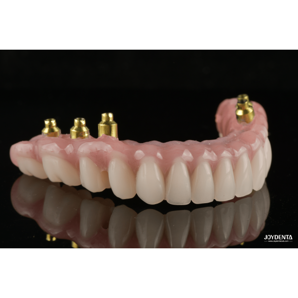 Quality The Strength of Titanium, The Art of Natural Aesthetics. for sale